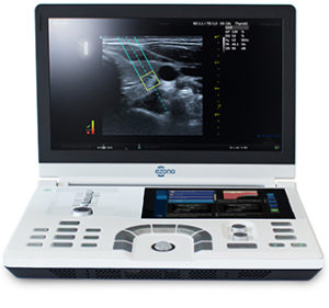 eZono® 5000 | Guiding you with vision